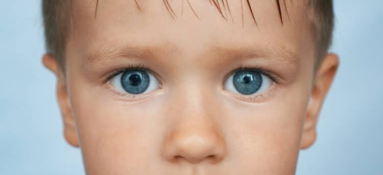 Anisocoria Bartlett | Neuro-Ophthalmology Wheaton - Naperville